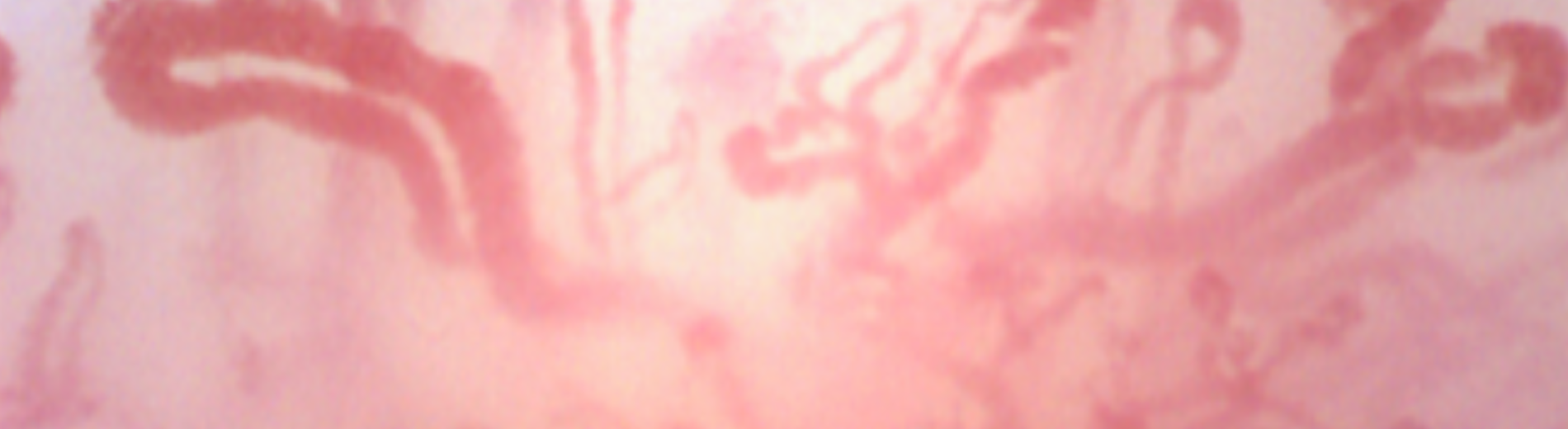 Course: CAPI: Capillaroscopic patterns in systemic sclerosis